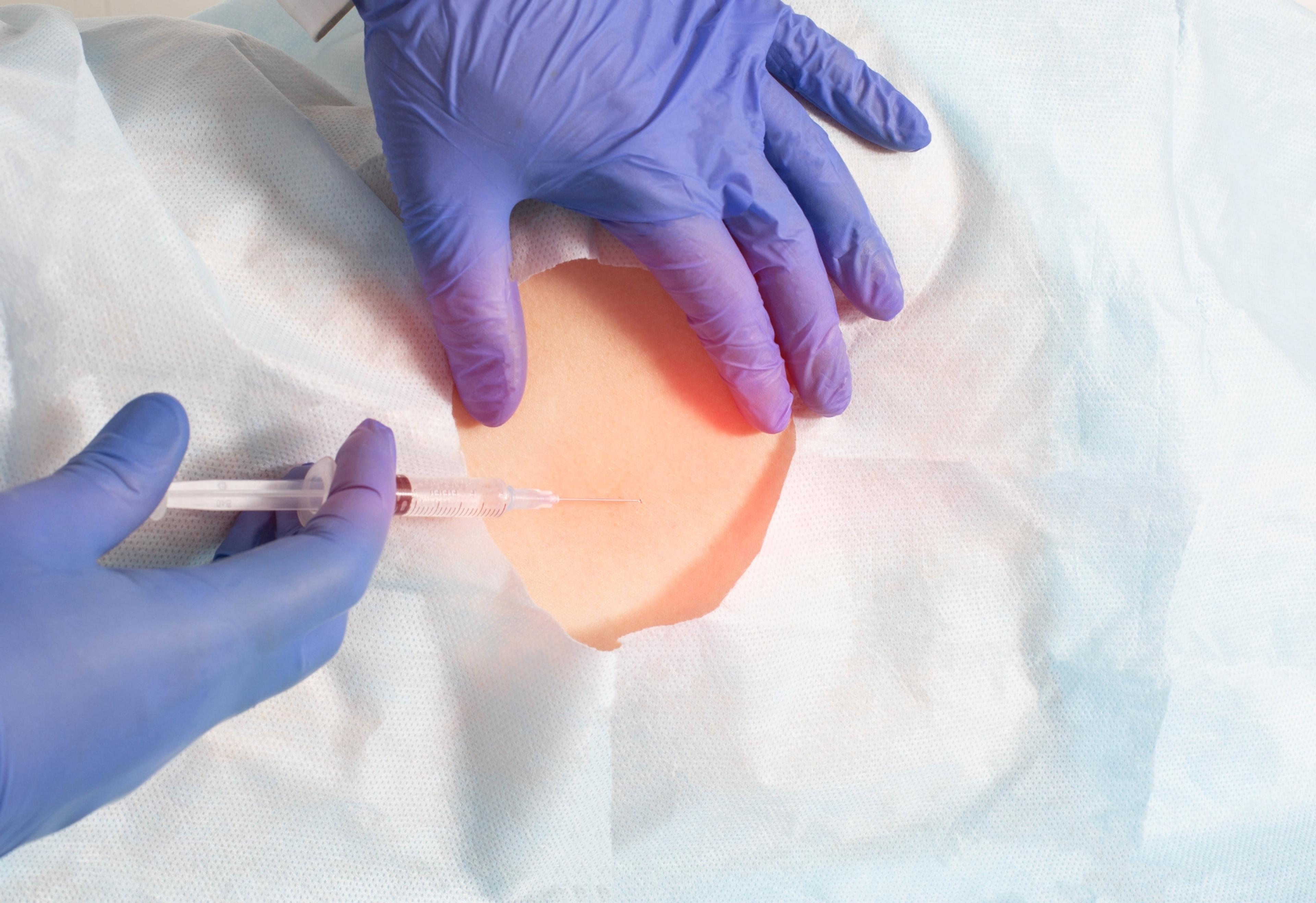 Interventional
